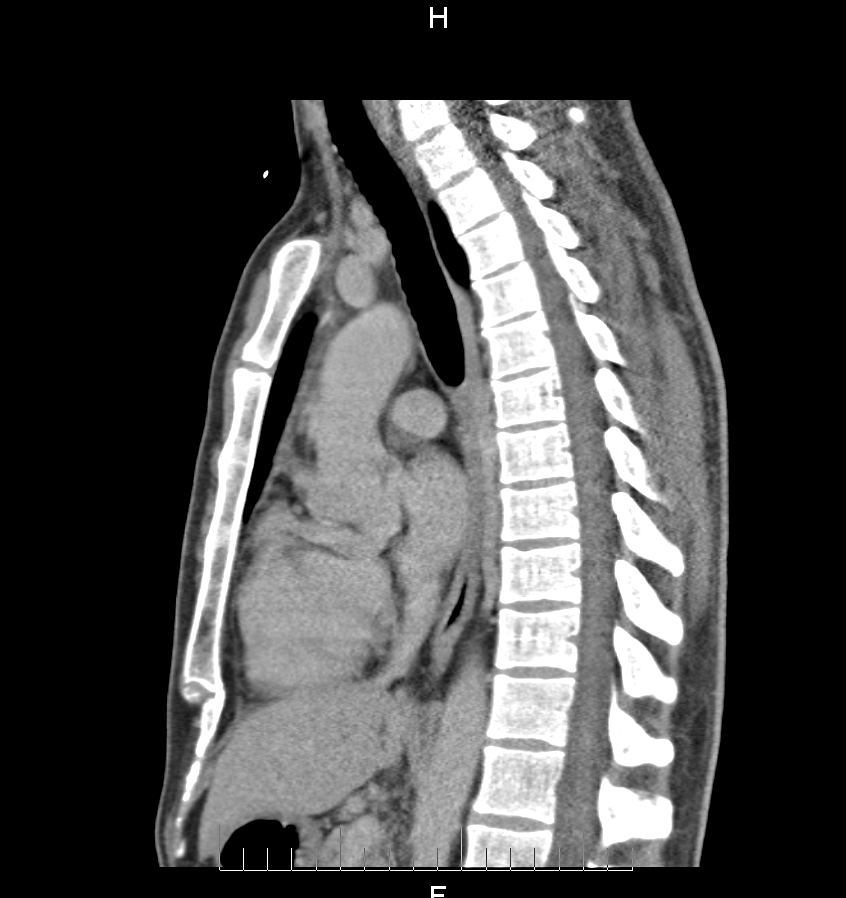 Los Angeles Types of Cancer Imaging | Cancer Center SoCal